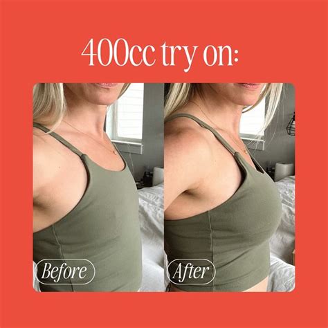 Swipe To See What 400cc Auggie Breast Implant Sizers Look Like Tried On