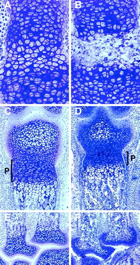 Bcl 2 Directly Affects Skeletal Development And Endochondral Bone