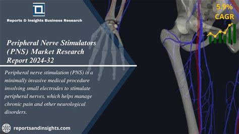 Peripheral Nerve Stimulators Pns Market Size 2024 32 Share Industry