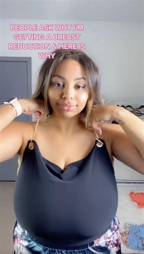 Woman Couldnt Breathe After Breasts Swelled To Giant 44h Size The Mirror