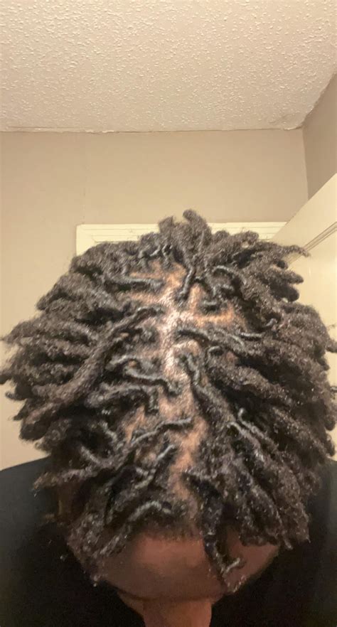 Can Someone Tell Me How Big My Locs Are Gonna Be Judging By The Parts