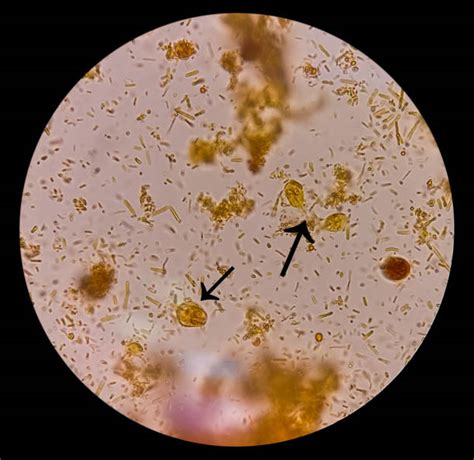Giardia Lamblia Cyst Slide