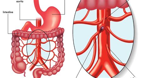 Congenital Genetic Defects And The Special Considerations For Prehospital Care