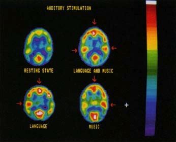 Mtec Music Therapy Month Series Music Therapy And Rehabilitation