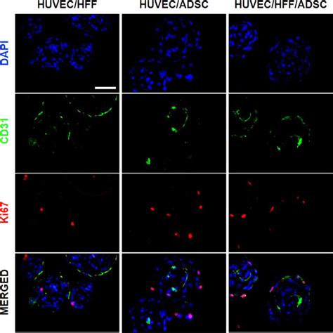 Double Staining Of Cd31 And Ki67 Within Spheroids Ihf Localization Of