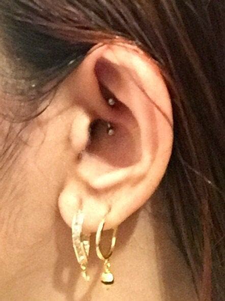 Picture Of Daith That Rejected Today After 1 12 Weeks Please Help Me