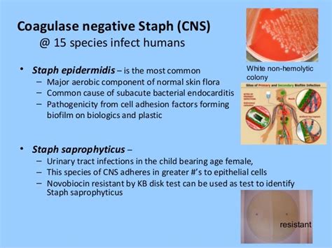 Antibiotics For Coagulase Negative Staph