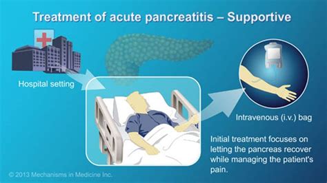Management And Treatment Of Acute Pancreatitis Artofit