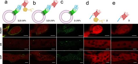 Modular Bioorthogonal Lipid Nanoparticle Modification Platforms For