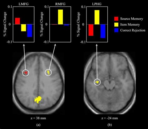 Item Memory And Source Memory Activation Results Selected Axial Slices
