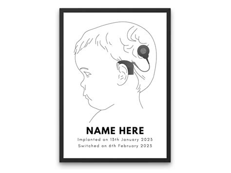 Cochlear Implant Switch On Activation Day Print Etsy