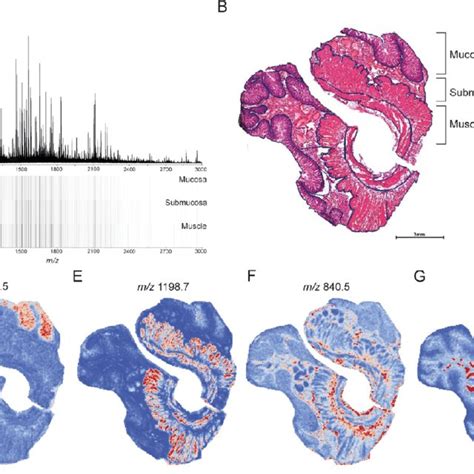 Maldi Tof Msi Of Distinct Histological Structures In The Human Small Download Scientific