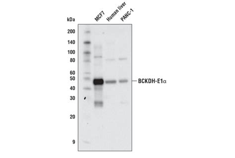 Bckdh E1 Alpha E4t3d Rabbit Monoclonal Antibody 90198 Datasheet