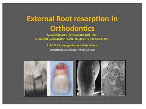 Root Resorption Oussama Sandid Mohamad Aboualnaser 1 Ppt