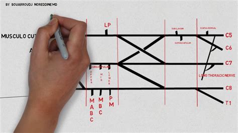 How To Draw Brachial Plexus For Anesthetists YouTube