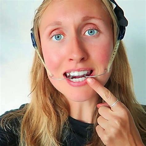 Pin By Bruce Nicolosi On Headgear Dental Braces Braces Girls