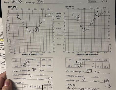 Anyone Have An Audiogram Like Mine Rhearingaids