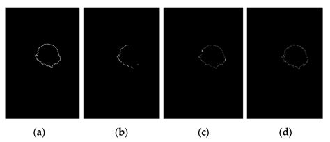 Diagnostics Free Full Text Breast Cancer Detection In Mammogram
