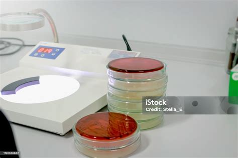 식민지 카운터 미생물 및 생명 공학 실험실 실험 개념 옆에 미생물 곰팡이 및 미생물 도자기 판탑의 성장 문화와 페트리 접시 유리