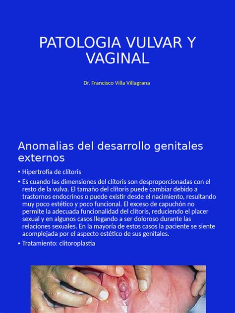 Patologia Vulvar Y Vaginal Pdf