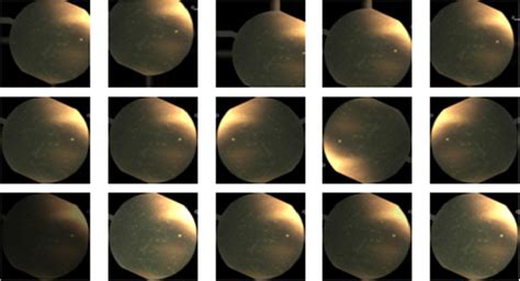 Figure 2 From Wireless Capsule Endoscopy Multiclass Classi Cation Using