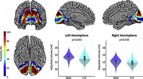 Cytoarchitectonically Defined Volumes Of Early Extrastriate Visual Cortex In Unmedicated Adults