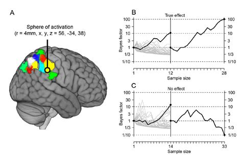 The Simulated Application Example A View Of The Right Hemisphere Of