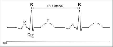 Standard Eeg Waveform And Rr Inter Beat Interval Download