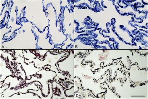Morphological Analysis Of The Features Of Elastic And Reticular Fibers Download Scientific