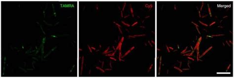 Nature子刊：仁济医院杨朝勇等通过荧光标记肠道菌群，提高粪便菌群移植治疗的可行性 知乎