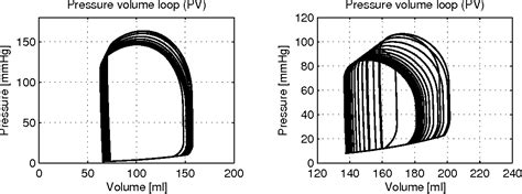Figure 11 From Simulations Of The Cardiovascular System Using The Cardiovascular Simulation