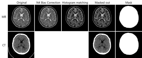 Github Chengbinjinmri To Ct Dcnn Tensorflow This Repository Is The Implementations Of The