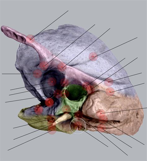 Temporal Bone Part 1 Diagram Quizlet