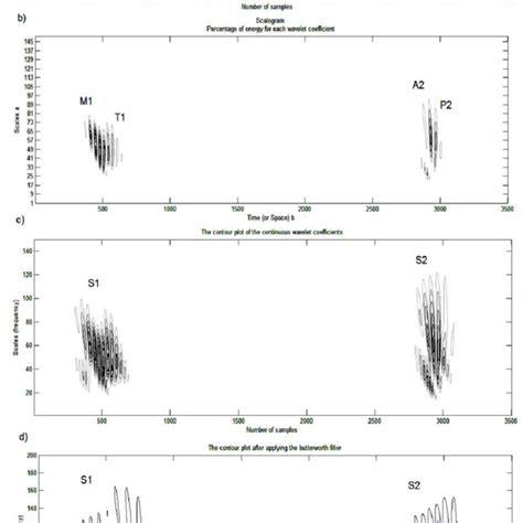 Analysis By The Continuous Wavelet Transform Of A Pcg Normal Signal Download Scientific Diagram