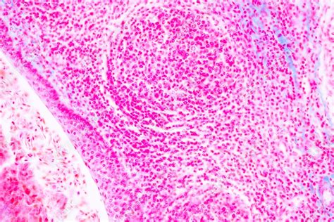 Trachea Thymus Parathyroid Gland And Tonsil Human Under The Microscope For Education In The