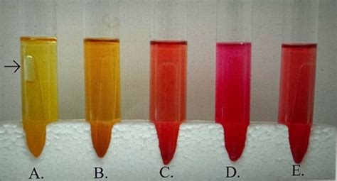 Microbiology Pr Urea Citrate Assignment Flashcards Quizlet