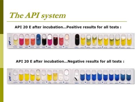 Microbiology 211 Ivytech Lab Test 2 Flashcards Quizlet