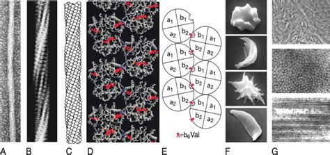 Pathobiology Of Sickle Cell Disease Clinical Tree