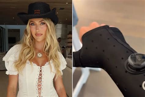 Brittany Mahomes Shows Off Medical Brace While Revealing A Pretty Bad