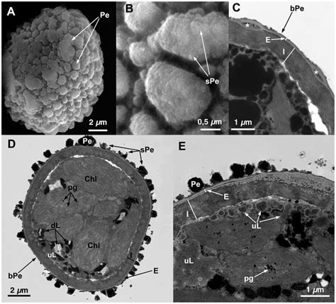 Spore Ultrastructure Of Orthotrichum Speciosum A Subspherical Spore