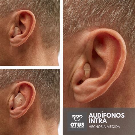 TIPOS DE AUDÍFONOS Audífonos OTUS