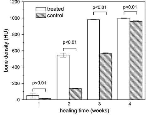 Bone Density Measurements Bone Density Values Expressed In Hounsfield