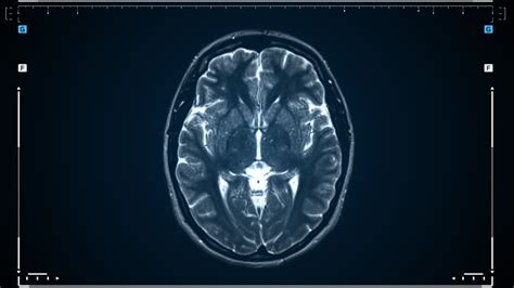 Buying Guide For Surgical Navigation System A Comprehensive Overview Of Medical Device