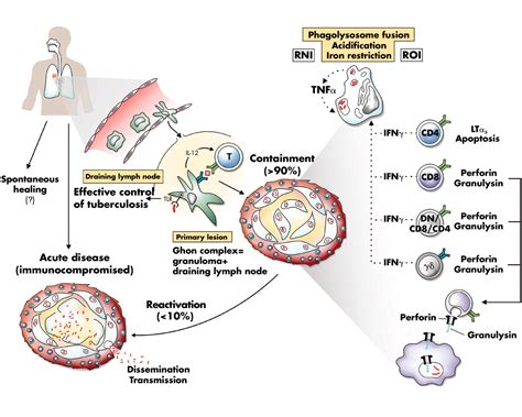 New Issues In Tuberculosis Annals Of The Rheumatic Diseases