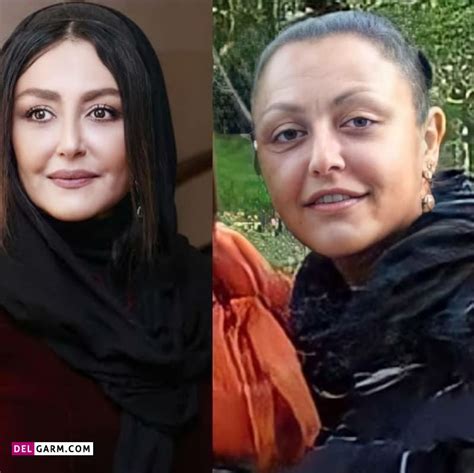 این عکس شقایق فراهانی شما را شوکه می کند