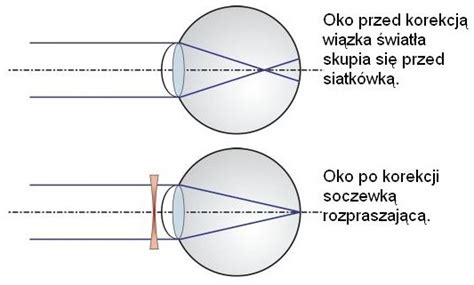 Ortopkorekcja Okulistyka Dziecięca Łódź