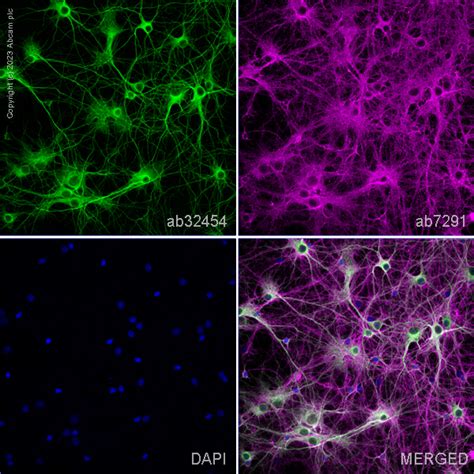 Anti Neun Antibody Neuronal Marker 1b7 Ab104224 Abcam