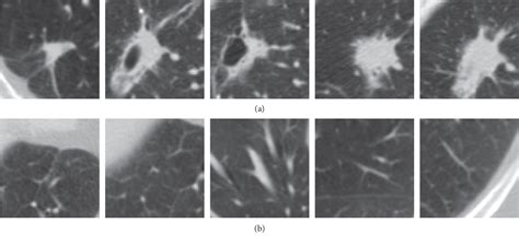 Figure 1 From Improving Accuracy Of Lung Nodule Classification Using