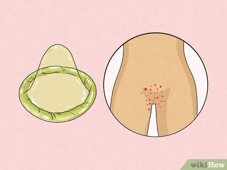 Easy Ways To Deal With Soreness After Sex WikiHow