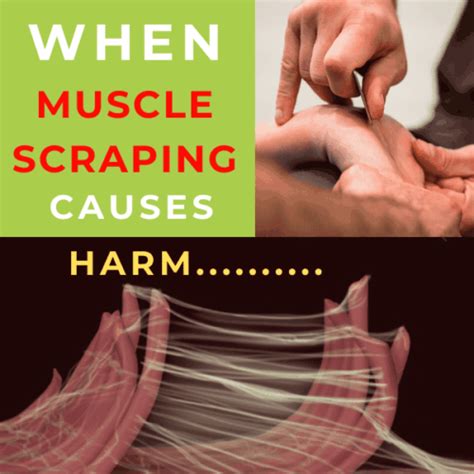 What Is Muscle Scraping At Arthur Ritchie Blog